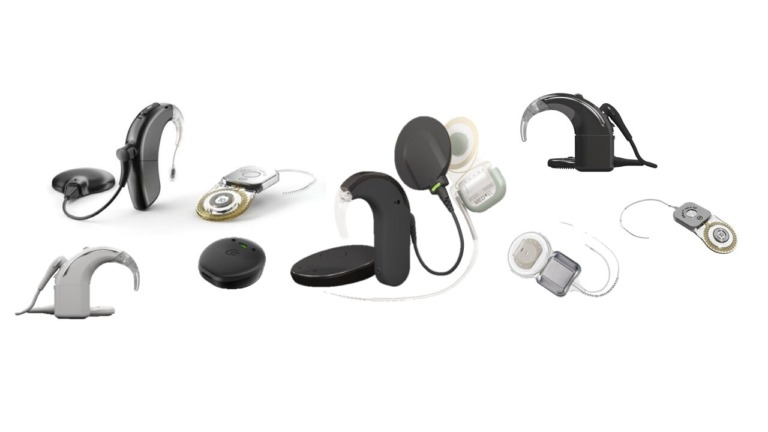 Cochlea Implant Centrum Ruhr - Klinik für Hals-Nasen-Ohren-Heilkunde ...